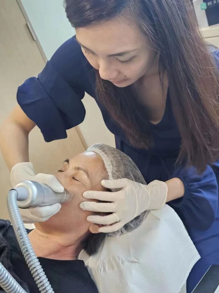 Acne Scars - Effective Laser Removal Treatment in Singapore