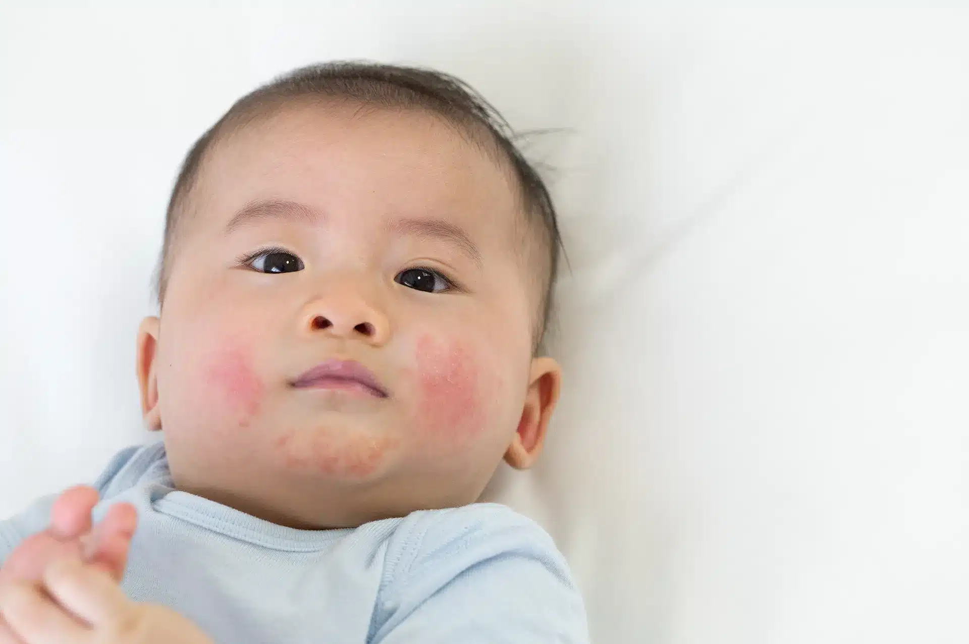 How to Know if Your Child Needs a Paediatric Dermatologist